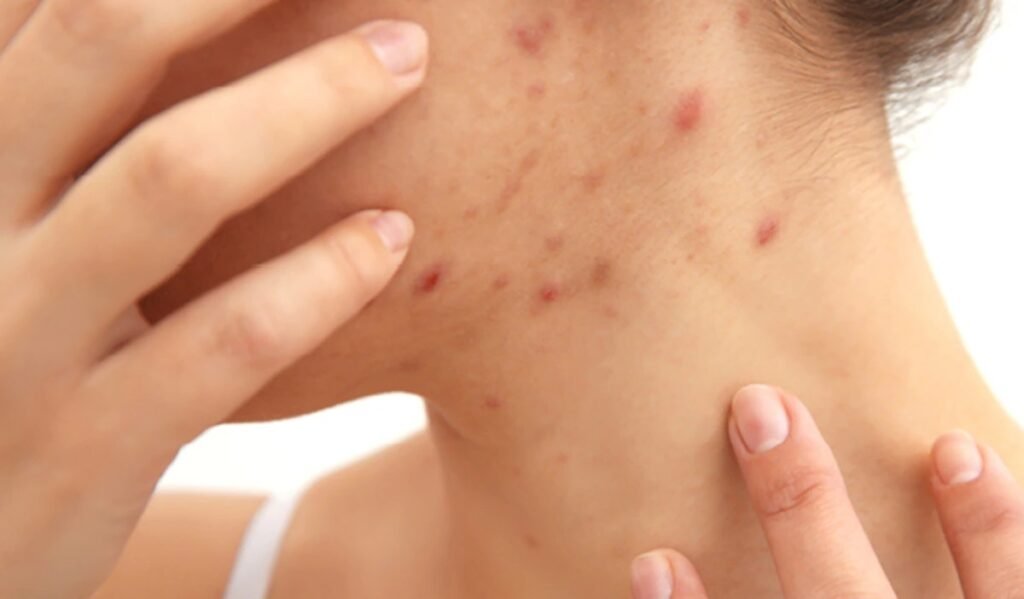 Skin Care Treatments| Best Treatment For Skin Pigmentation